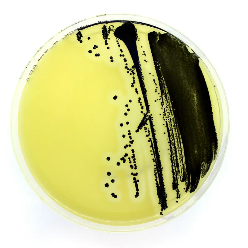 BOITE PRECOULE DIA 90mm GELOSE YGC (YEAST GLUCOSE CHLORAMPHENICOL AGAR ...