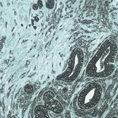 BrightDiluent, blue antibody diluent // Category: IHC