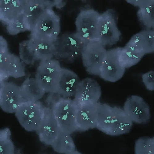 ZytoLight SPEC TP53/CEN 17 Dual Color Probe // Category: FISH/CISH